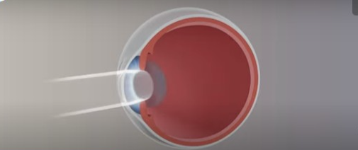 Refractify – Virtual Optical Layer – Encausse.net